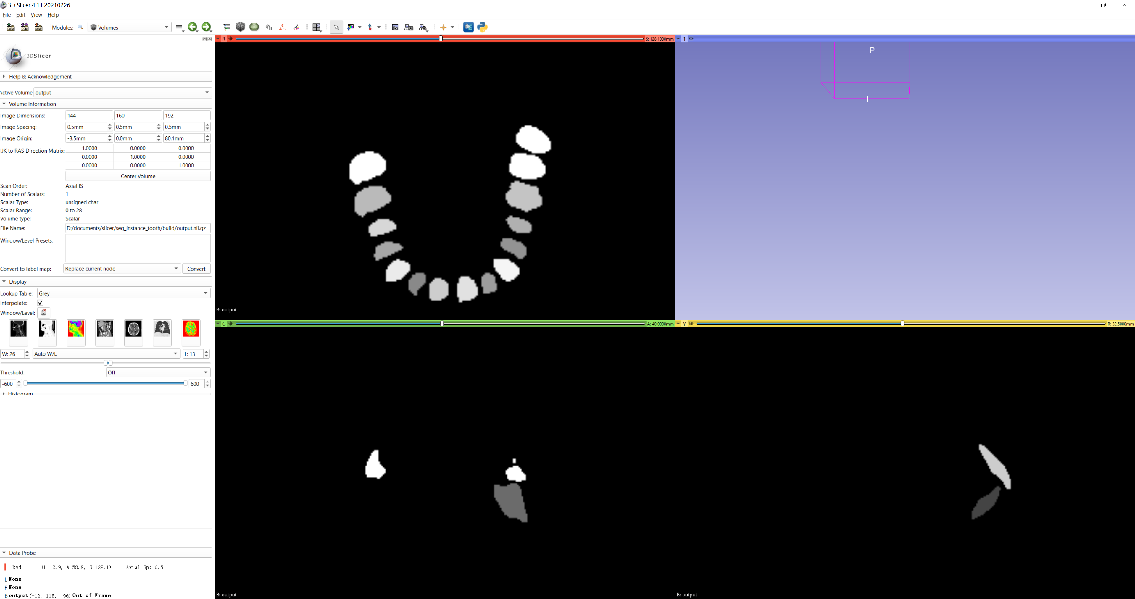 Slicer学习笔记（四十）slicer从volume生成labelmap并显示_3d slicer导入label不显示-CSDN博客