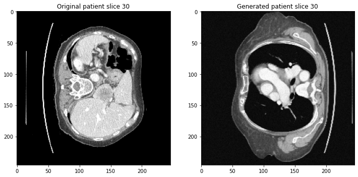 使用 Python 和 Monai 来扩充您的数据集以进行肿瘤或器官分割_python的addchanneld函数-CSDN博客