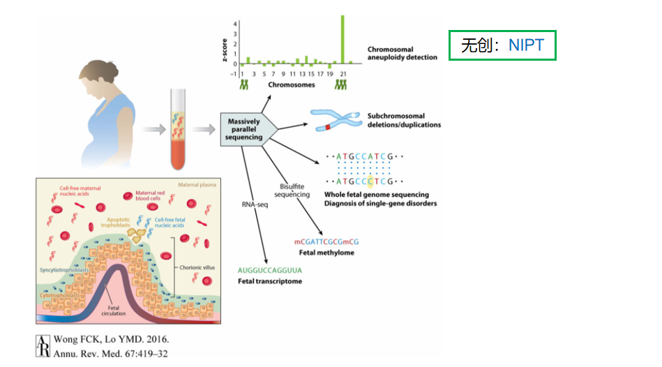 生信分析：无创产前检测_nipt数值解读-CSDN博客