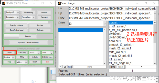 SPM进行原点矫正--手动操作：_spm当中的原点矫正-CSDN博客