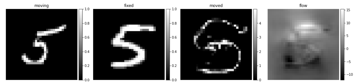 VoxelMorph-无监督医学图像配准-代码讲解-CSDN博客