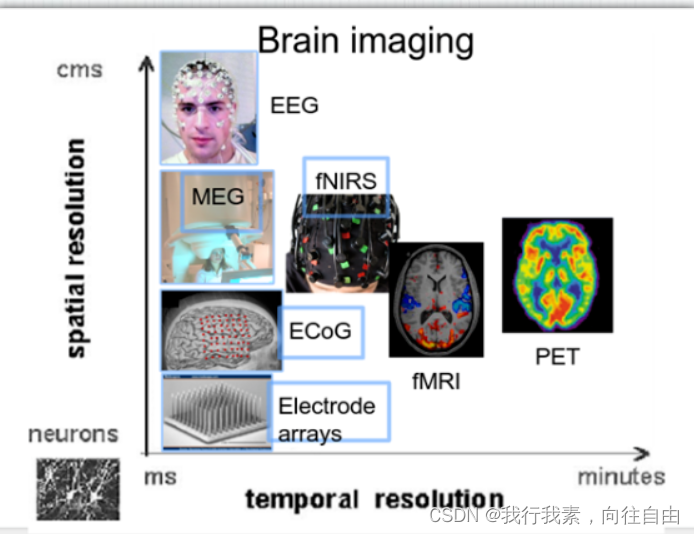 脑机接口BCI初识_bci脑机接口按照脑电信号采集的方式,可以分成?-CSDN博客