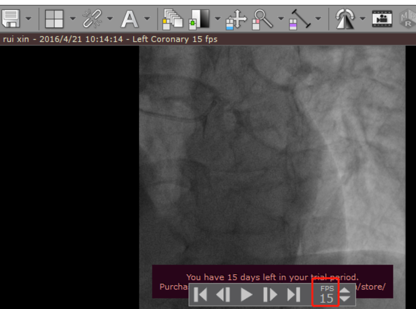 13. DICOM图像显示-DCMTK-处理多帧图像_dicom 多帧图像-CSDN博客