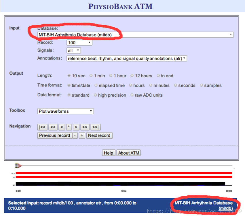 从0开始学心电信号处理（1）——心电信号的读取_wfdb.rdrecord-CSDN博客
