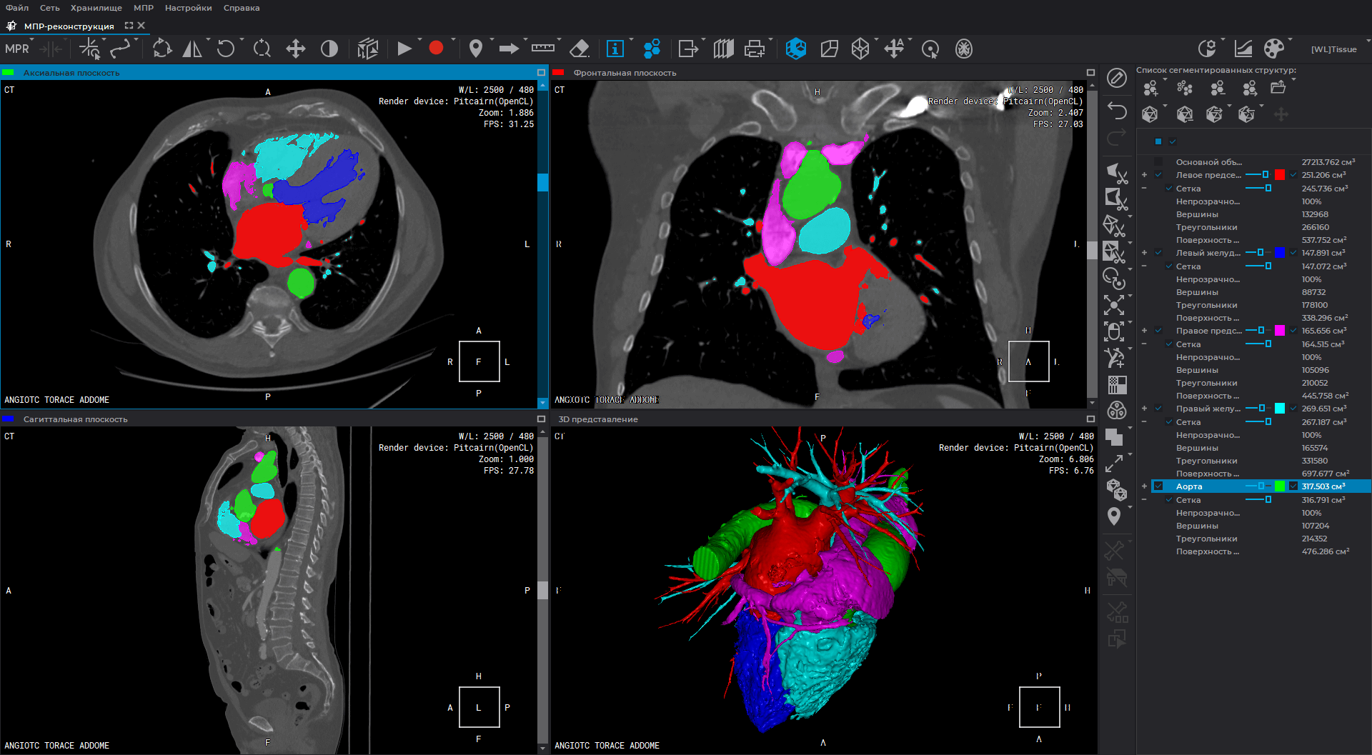 Inobitec DICOM Viewer Pro 2.6.1-CSDN博客