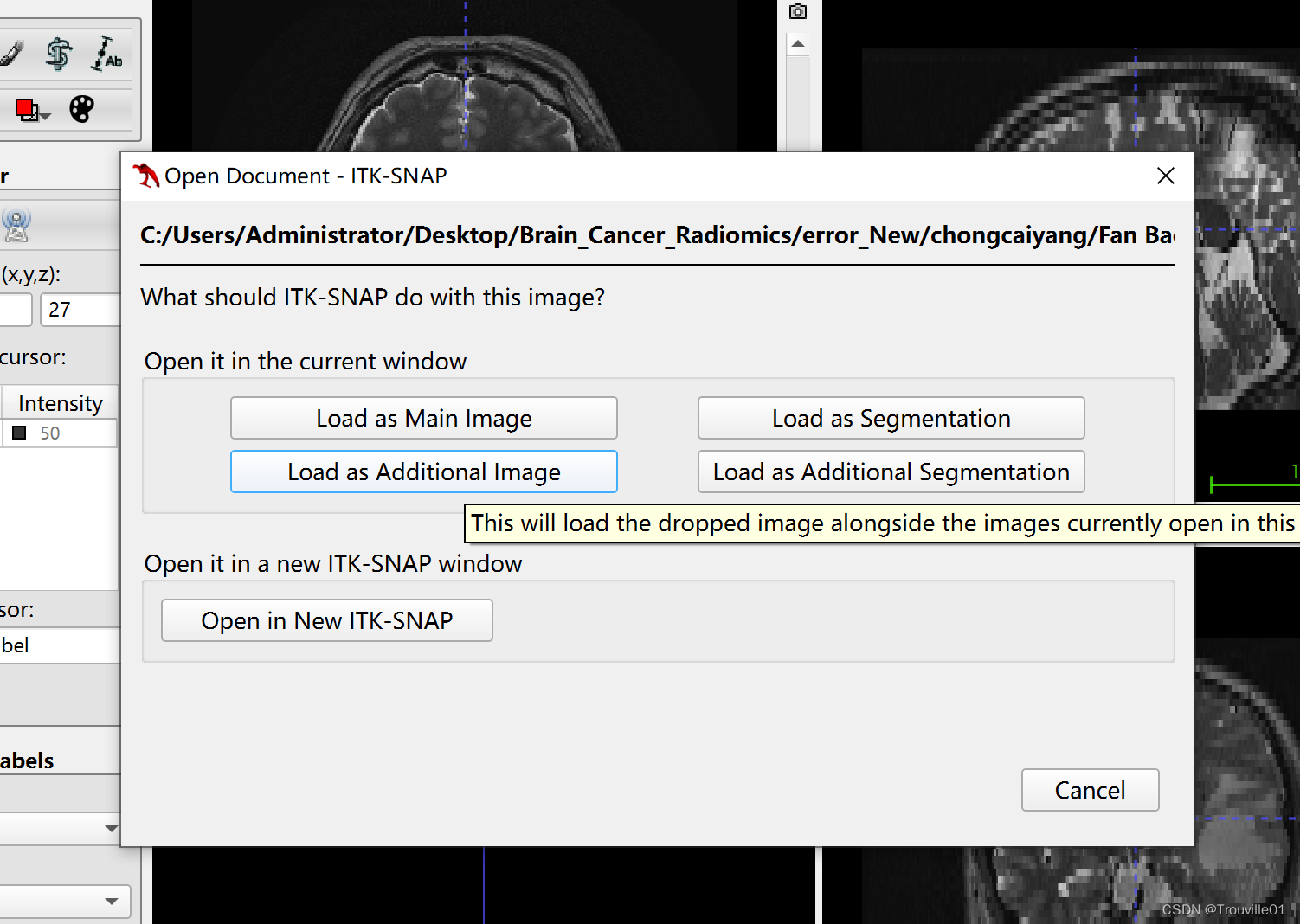 介绍一种医学影像配准的方法（使用itk-snap)_itksnap使用教程-CSDN博客