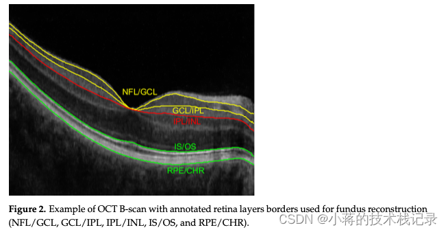 Neural Networks Application for Accurate Retina Vessel Segmentation from OCT Fundus ...