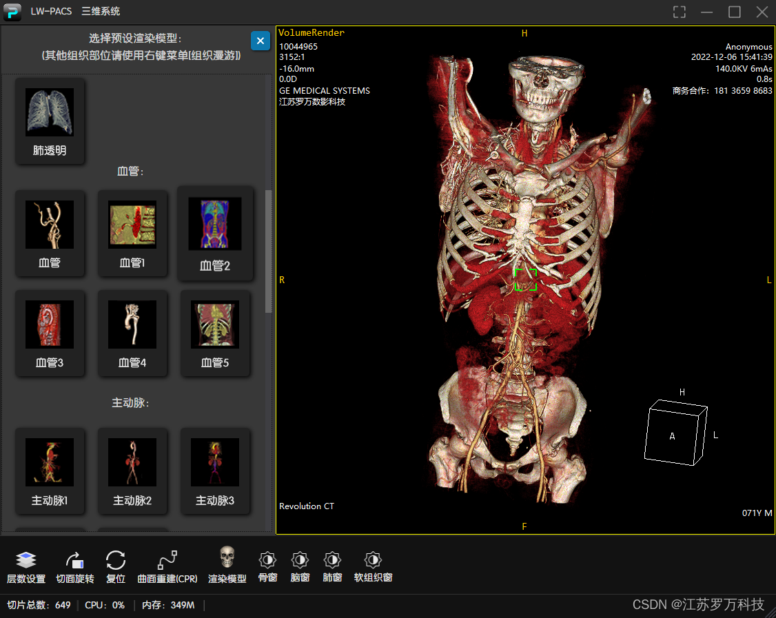 C开发pacs医学影像三维重建一使用vtk重建3d影像c Vtk Csdn博客