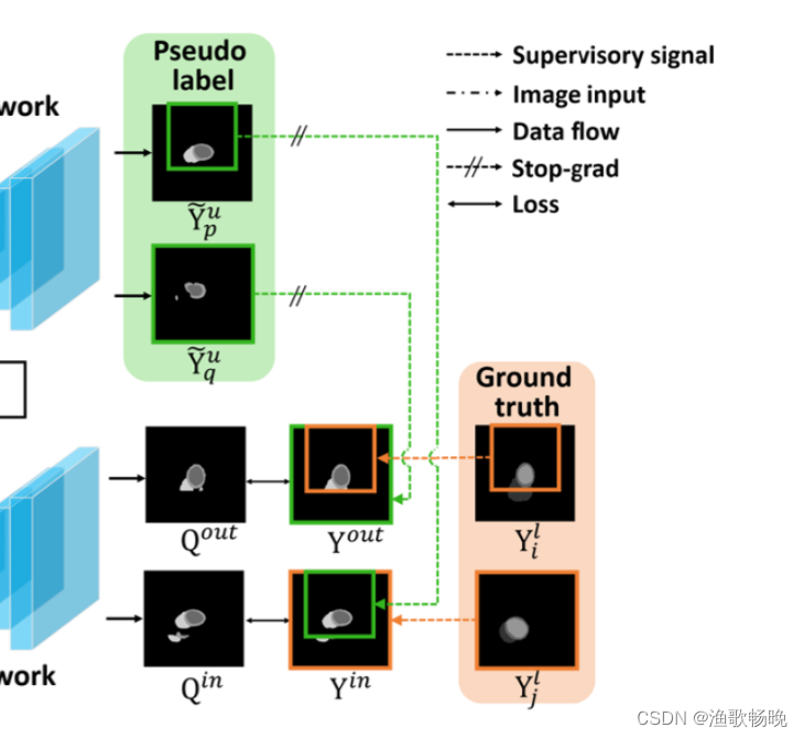 论文解读《Bidirectional Copy-Paste for Semi-Supervised Medical Image Segmentation》-CSDN博客