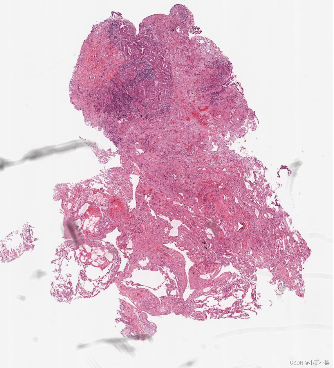 Python大作业 数字病理学图像svs文件任意倍率浏览-CSDN博客