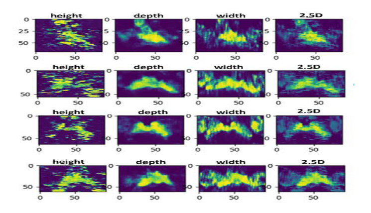 A 2.5D Cancer Segmentation for MRI Images Based on U-Net_2.5d分割 深度学习-CSDN博客