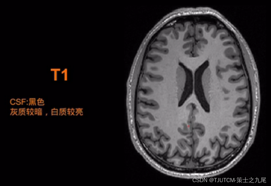 MRI原理与CEST相关简介_cest mri-CSDN博客