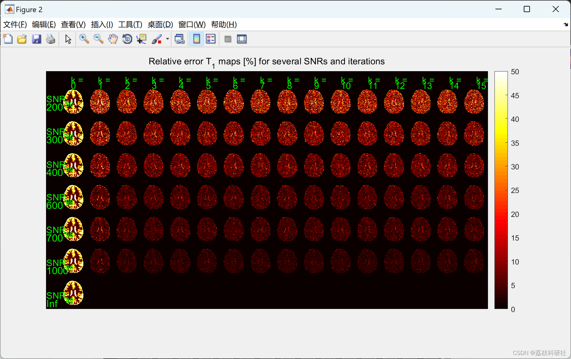 【核磁共振T1映射】基于NLLS的新型算法从 SPGR 信号准确精确估计高分辨率的T1加权图像研究（Matlab代码实现）_t1 mapping matlab-CSDN博客