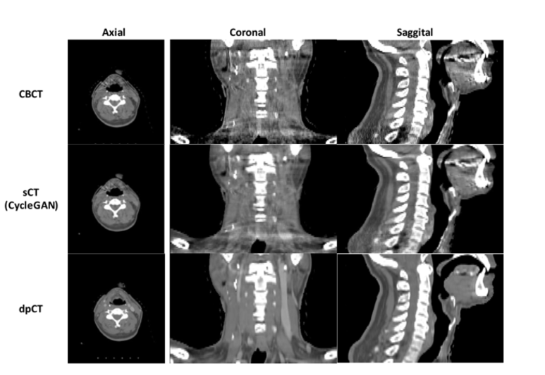 CycleGAN在医学图像中的应用_医学图像cyclegan-CSDN博客
