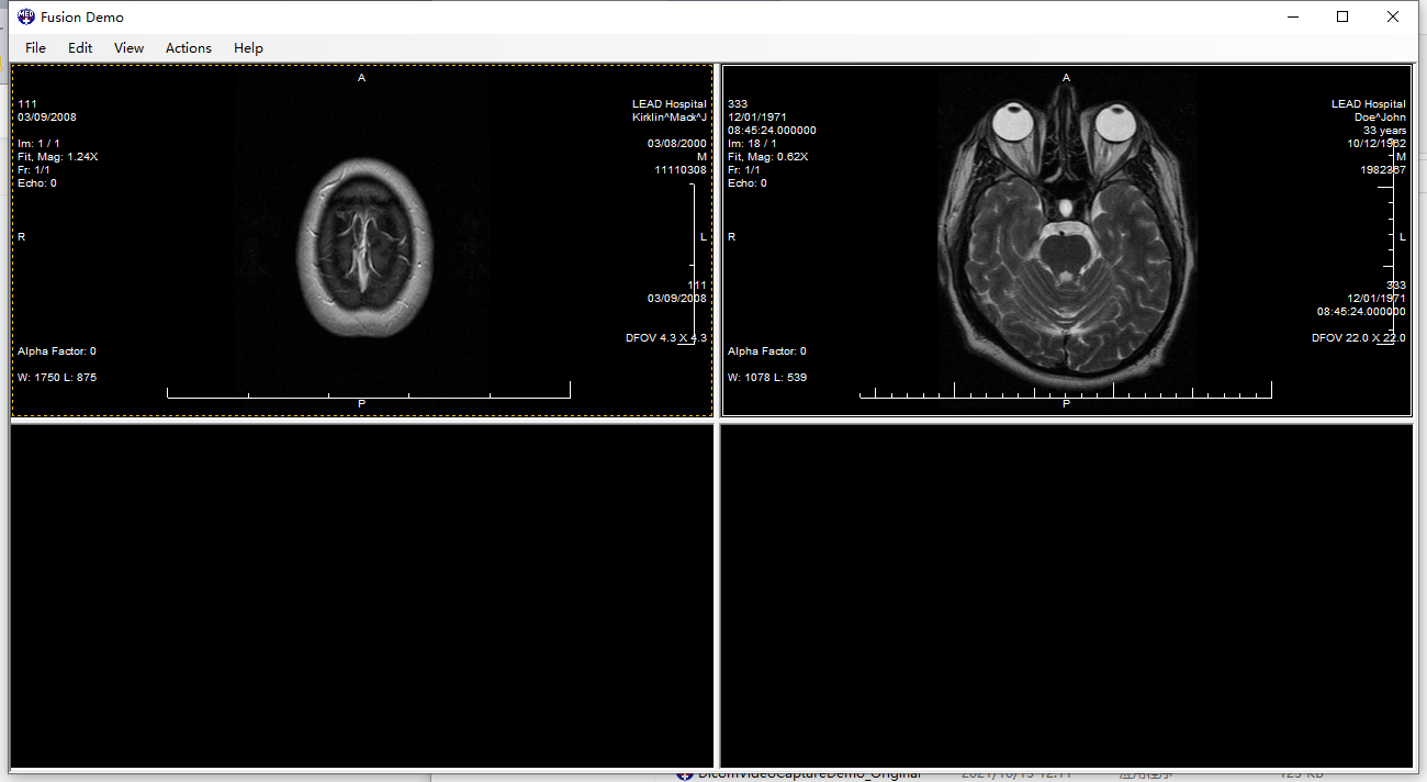 LEADTOOLS V22.0 (09-20-2021)-Crack_leadtools v22 下载-CSDN博客