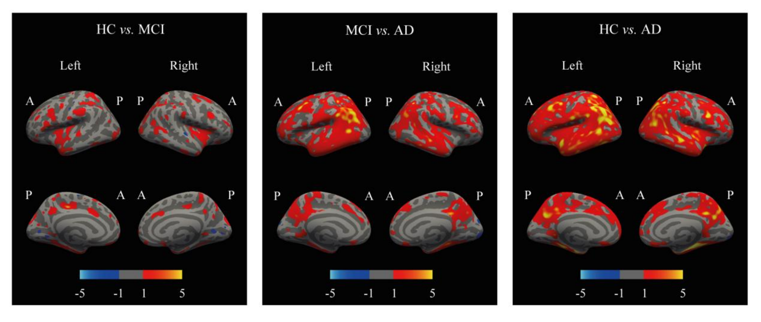 Freesurfer_T1_组分析-01（完美版）_setenv study $argv[1]-CSDN博客