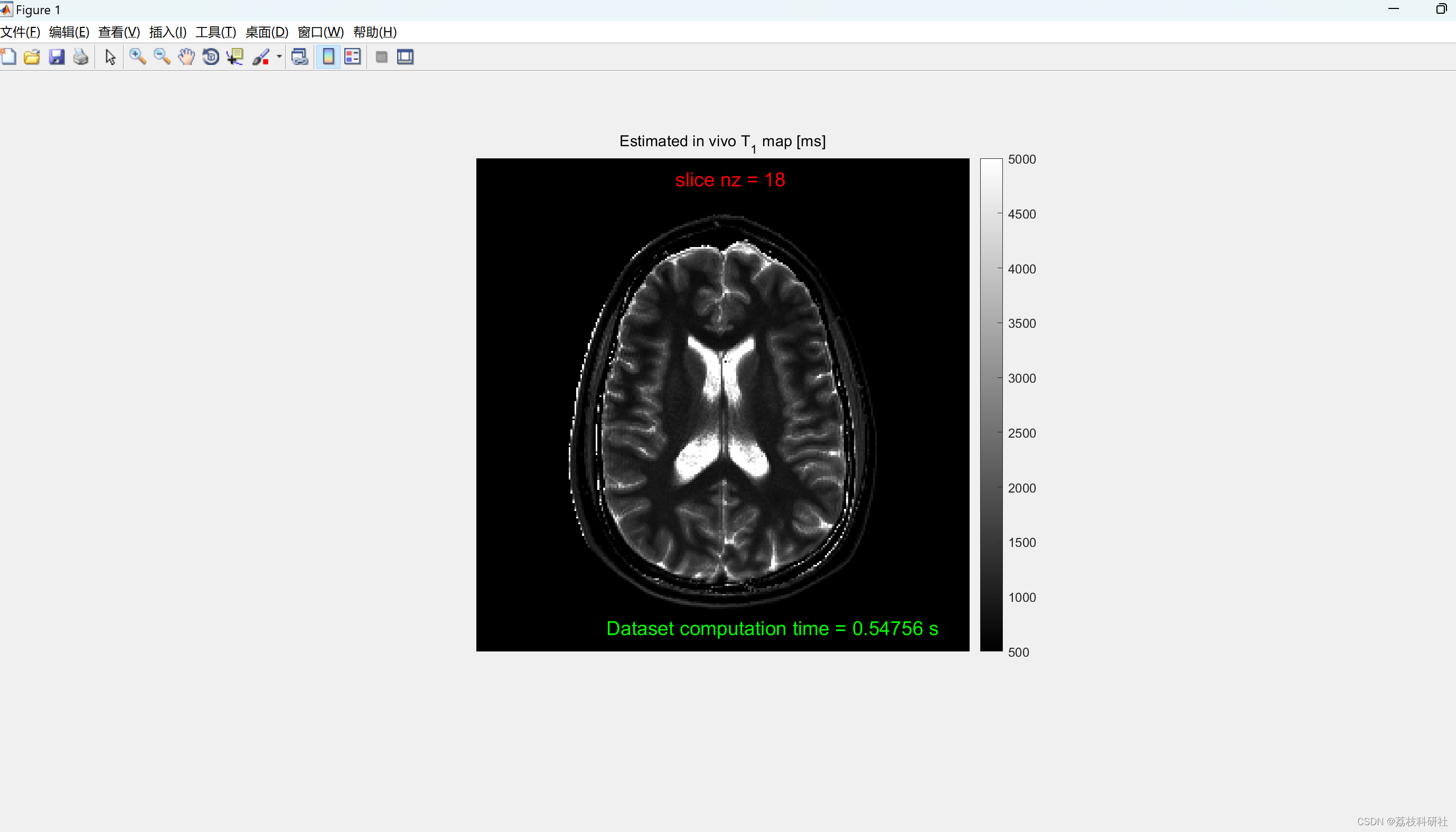 【核磁共振】用于准确和精确的VFA MRI的快速算法研究（Matlab代码实现）_大数据算法肺癌的核磁共振代码-CSDN博客