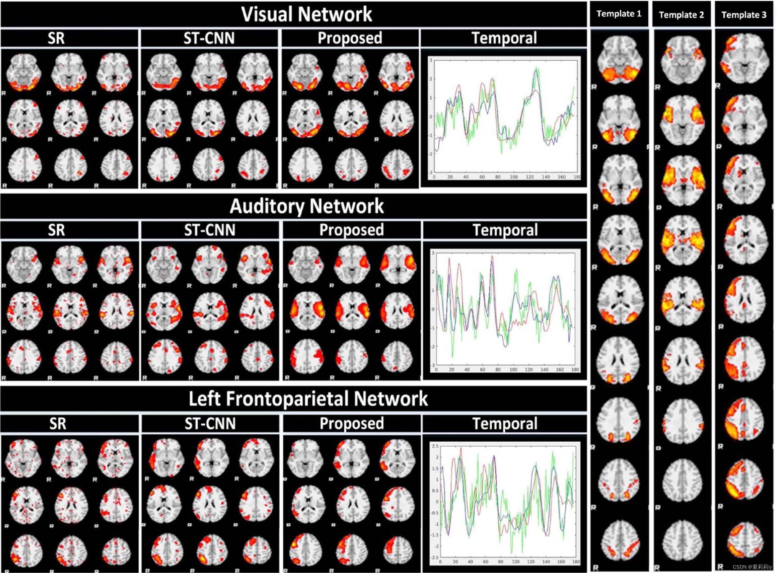 [论文精读]Characterizing functional brain networks via Spatio-Temporal Attention 4D Convolutional ...