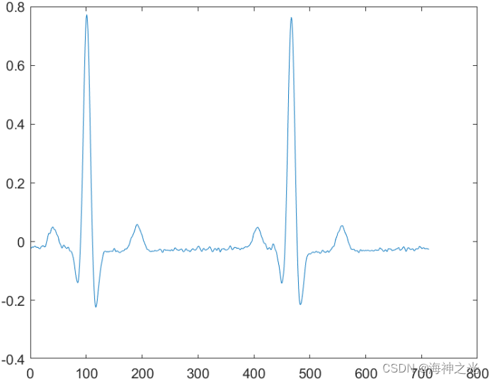 【心电信号 】基于matlab ECG心电信号QRS波群特征提取【含Matlab源码 3385期】_qrs波特征提取-CSDN博客