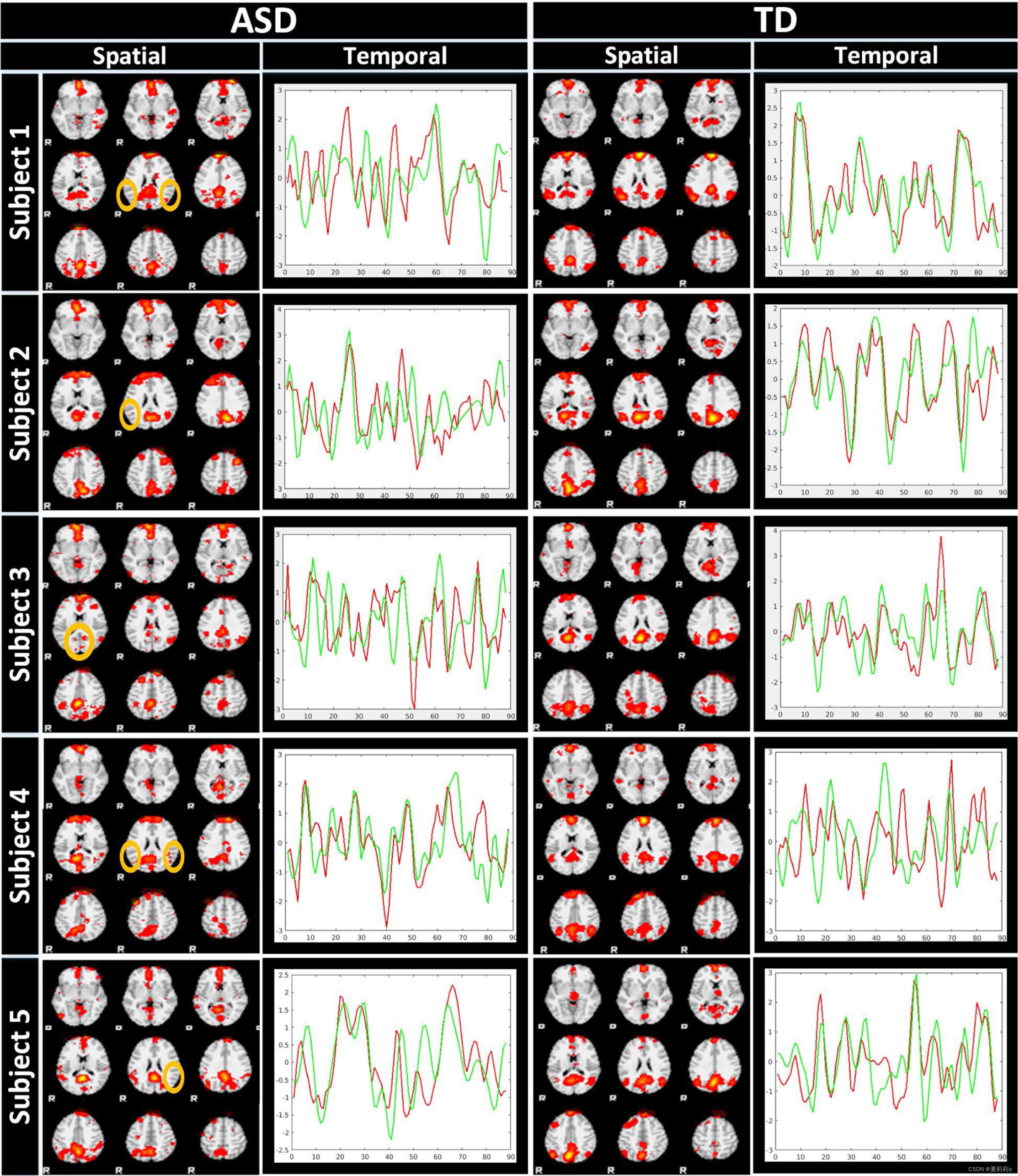 [论文精读]Characterizing functional brain networks via Spatio-Temporal Attention 4D Convolutional ...