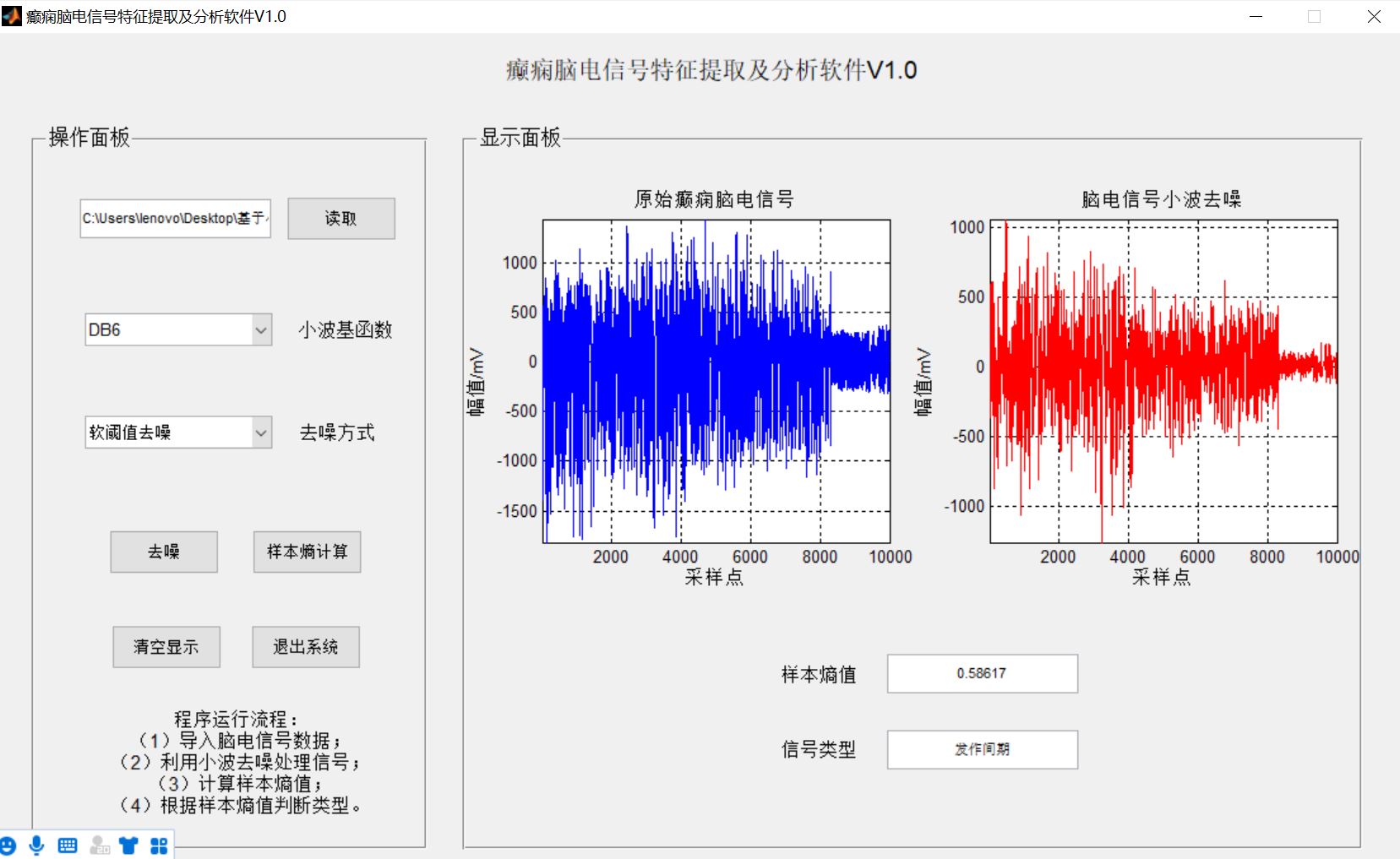 【脑电信号】基于matlab Gui小波变换癫痫脑电信号特征提取及分析【含matlab源码 1154期】脑电信号采集系统的设计与开发matlab Csdn博客 