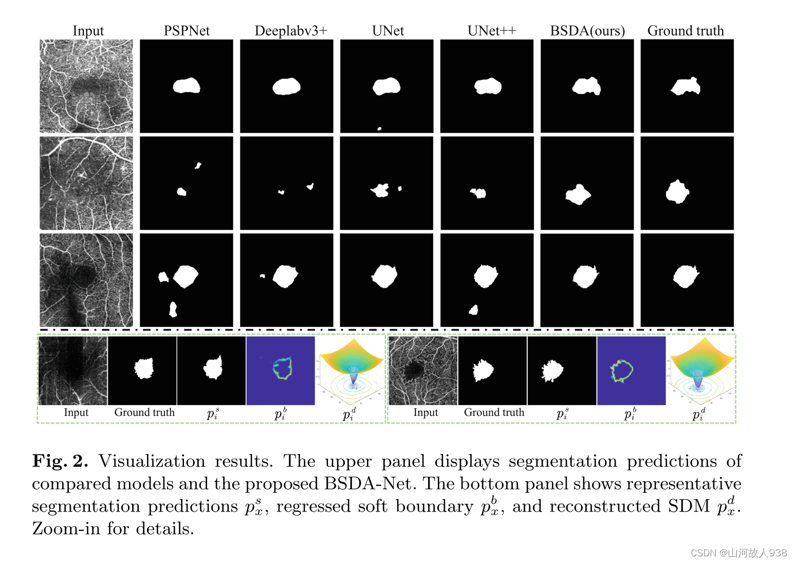 BSDA-Net: A Boundary Shape andDistance Aware Joint LearningFramework for Segmenting ...