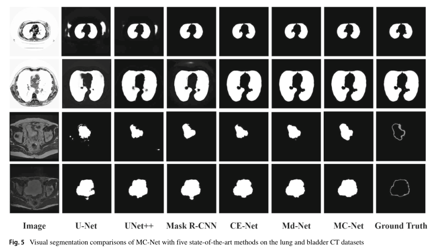 MC-Net: multi-scale context-attention network for medical CT image ...