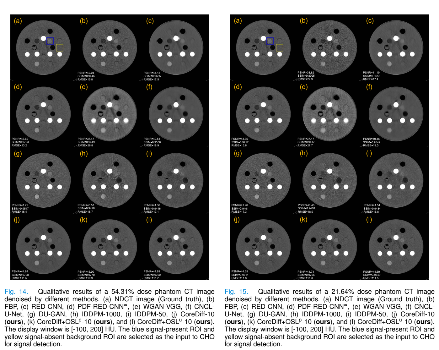 Contextual Error-Modulated Generalized Diffusion Model for Low-Dose CT ...