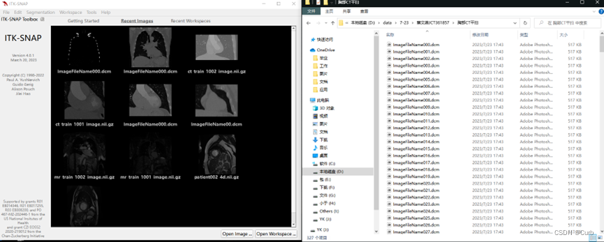 ITK-snap医学图像标注方法（超级详细）——保姆级_itk snap-CSDN博客