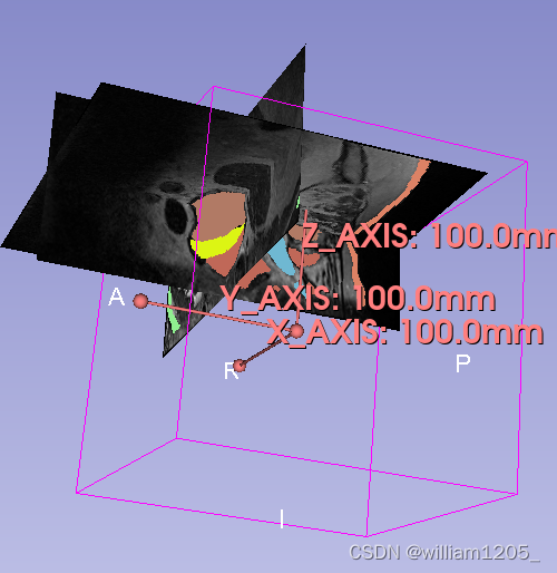 关于3Dslicer和SimpleITK各自的origin，direction，spacing，（和size）_3d slicer对比图像-CSDN博客