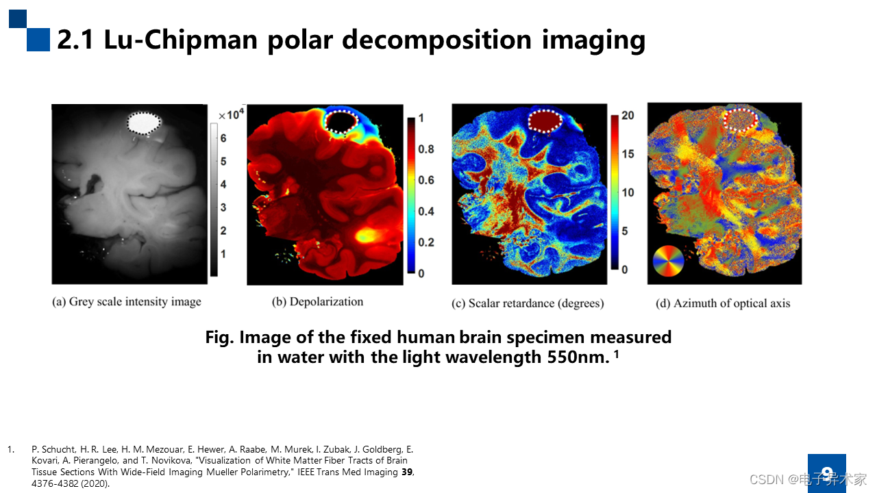 [PPT] Application of Polarization Imaging Techniques in Brain Tumor Detection 偏振成像技术在脑肿瘤检测中的应用 ...
