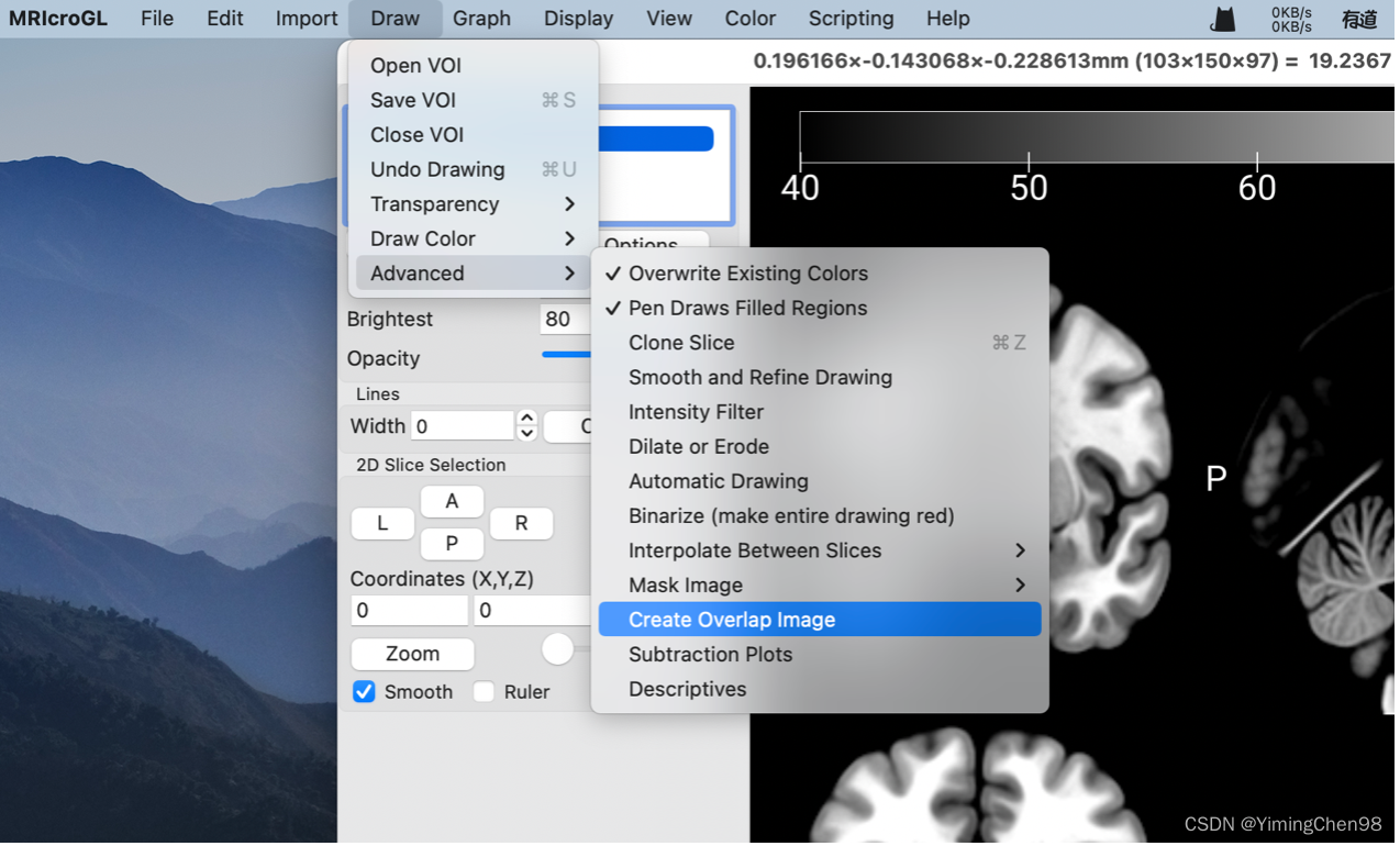 使用Matlab SPM12与MRIcroGL进行头核磁ROI的标准化与Overlap图的制作_YimingChen98的博客-CSDN博客