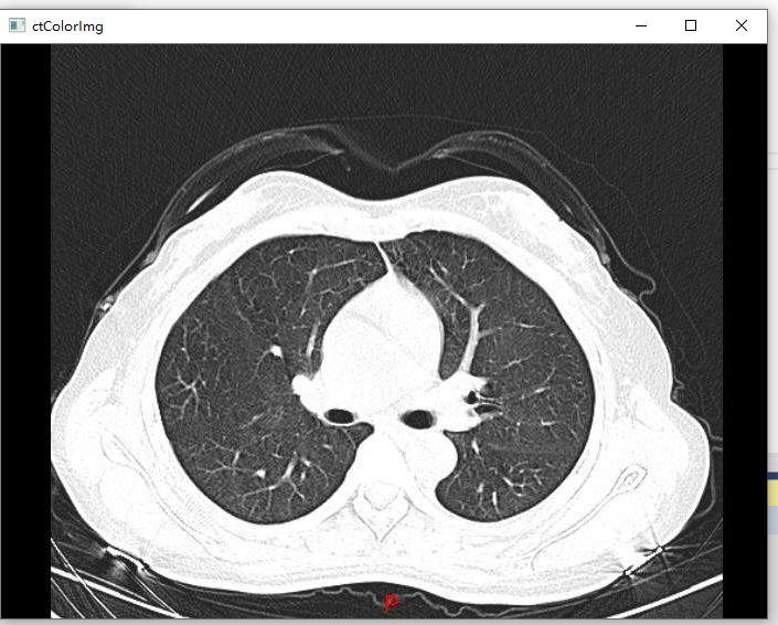 利用opencv的函数houghcircles实现霍夫梯度法圆检测时参数dp的值对于最终结果影响是挺大的houghcircles Dp Csdn博客