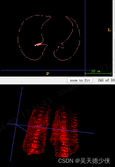 Pythonsimpleitk获取3d图像的轮廓simpleitk 3d绘制 Csdn博客