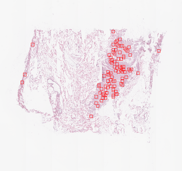 TCGA数据库中WSI图像的切割_wsi图像一般多大-CSDN博客
