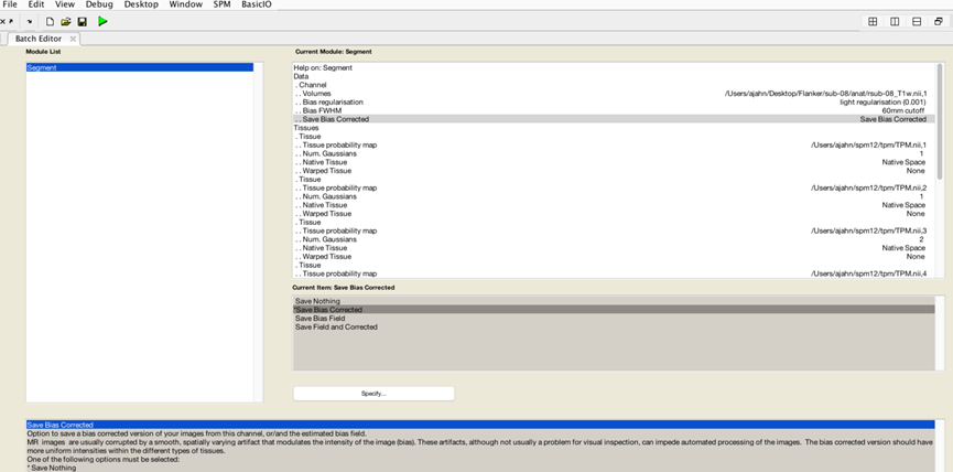 基于spm12对fMRI数据分析_spm12的tpm-CSDN博客