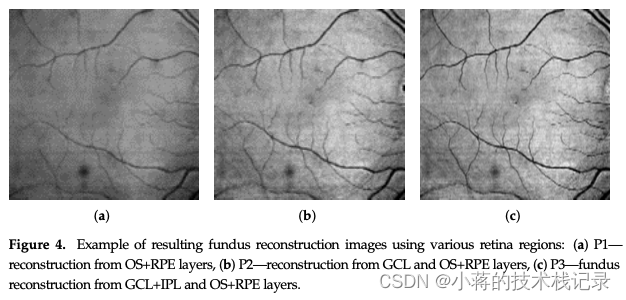 Neural Networks Application for Accurate Retina Vessel Segmentation from OCT Fundus ...