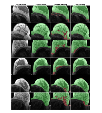 Medical Diffusion - Denoising Diffusion Probabilistic Models for 3D ...