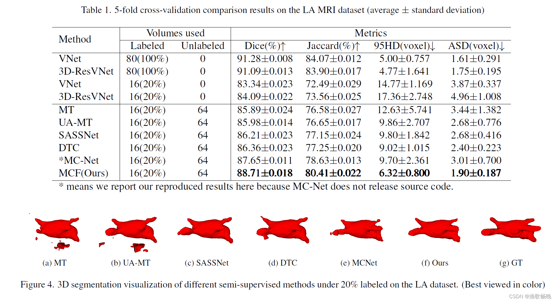 论文解读《Mutual Correction Framework for Semi-Supervised Medical Image Segmentation》_mcf: mutual ...