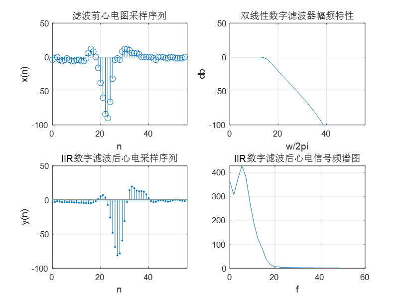 IIR数字滤波器的设计及应用——MATLAB_iir数字滤波器设计-CSDN博客