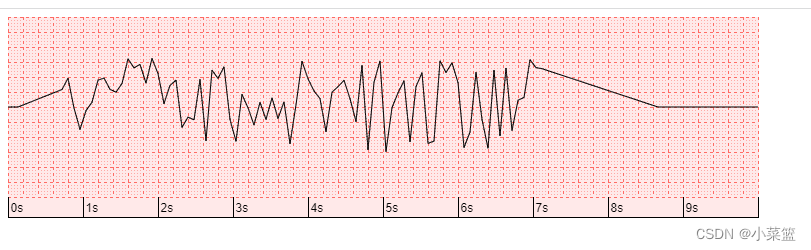 Canvas案例-实现ECG心电图_canvas vue实现心电图-CSDN博客