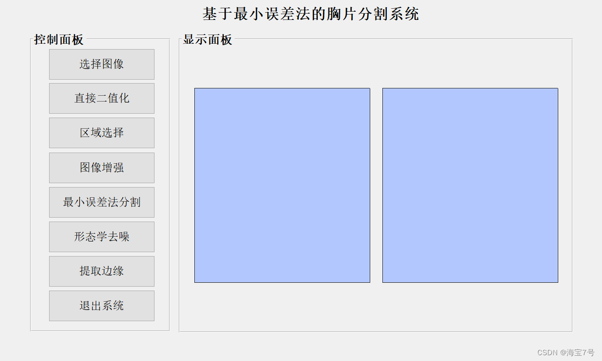 【第 26 章 基于最小误差法和区域生长的医学影响分割系统 Matlab深度学习实战gui项目】基于matlab Gui的医用系统开发 Csdn博客