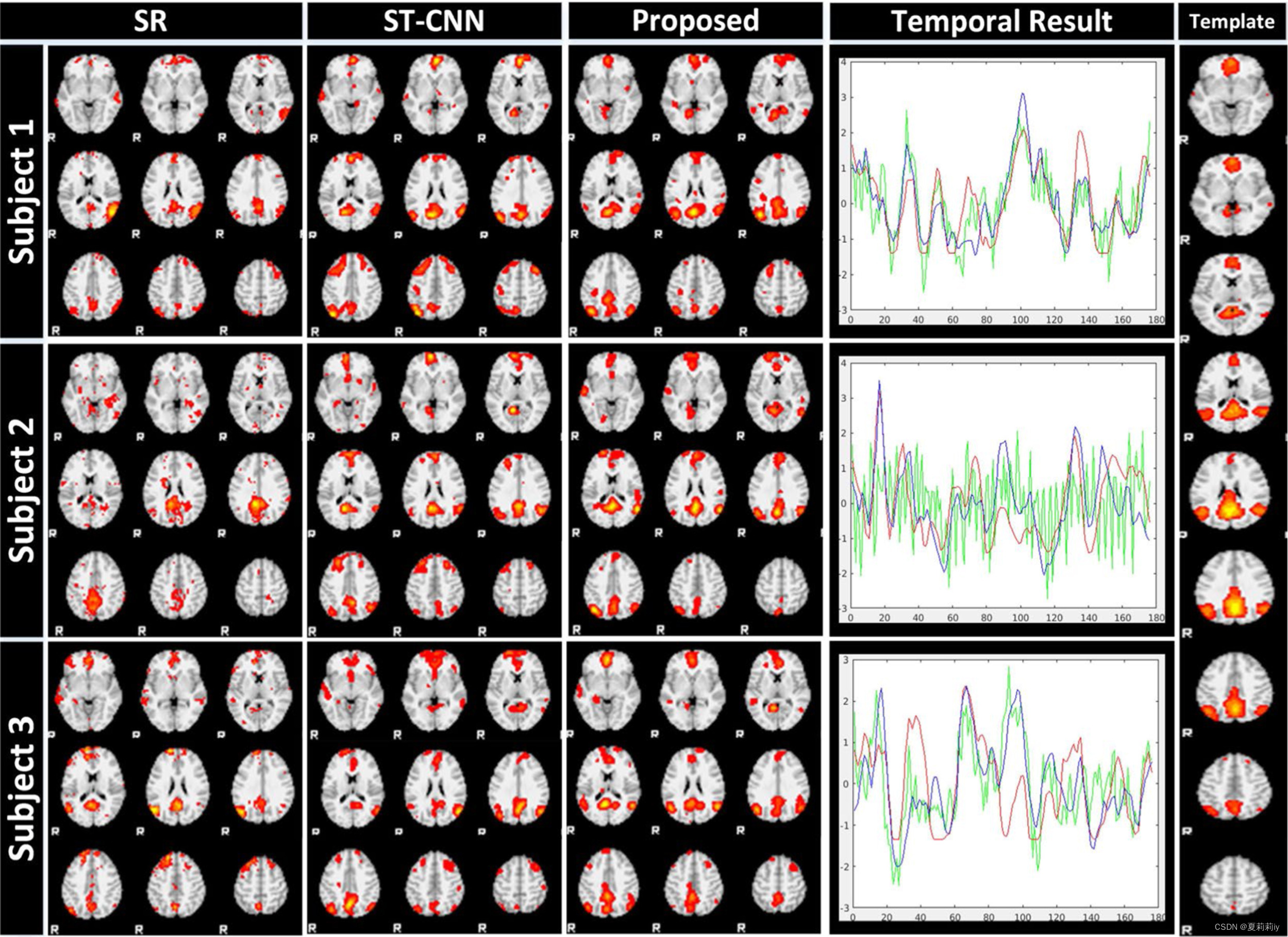 [论文精读]Characterizing functional brain networks via Spatio-Temporal Attention 4D Convolutional ...