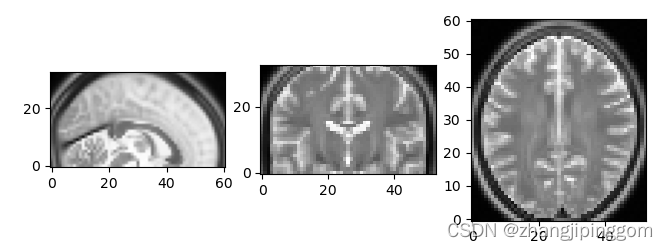 nib plt可视化_python可视化nibabel-CSDN博客