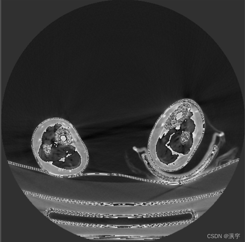 Itk Dicom序列图像读写imageseriesreader Csdn博客