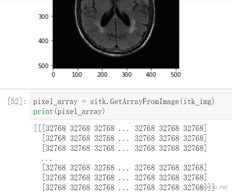医院MR图像的pixel array 数字过大解决方案_图像处理协方差矩阵,矩阵太大怎么办-CSDN博客