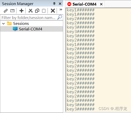 ARM Cortex-A7核按键中断实验_arm a7单片机中断处理程序怎么写-CSDN博客