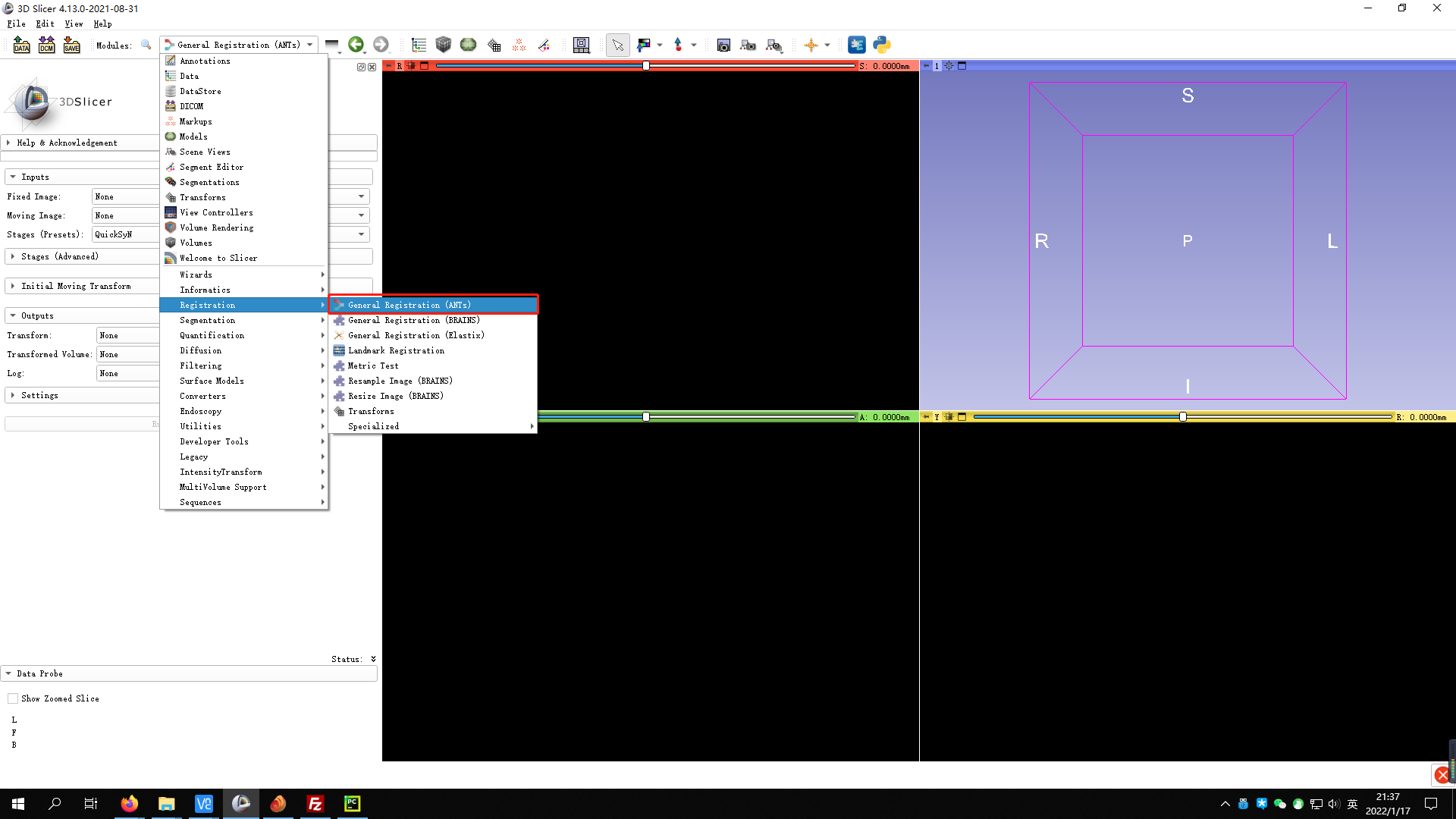3D Slicer——配准篇(基于ANTs工具)详细教程_ants配准-CSDN博客