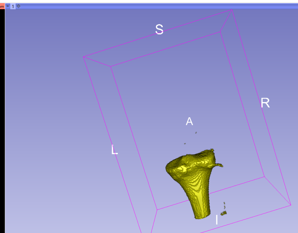Slicer学习笔记（二十九）slicer指定标签颜色_3d slicer加载三维标签后如何调整标签颜色-CSDN博客