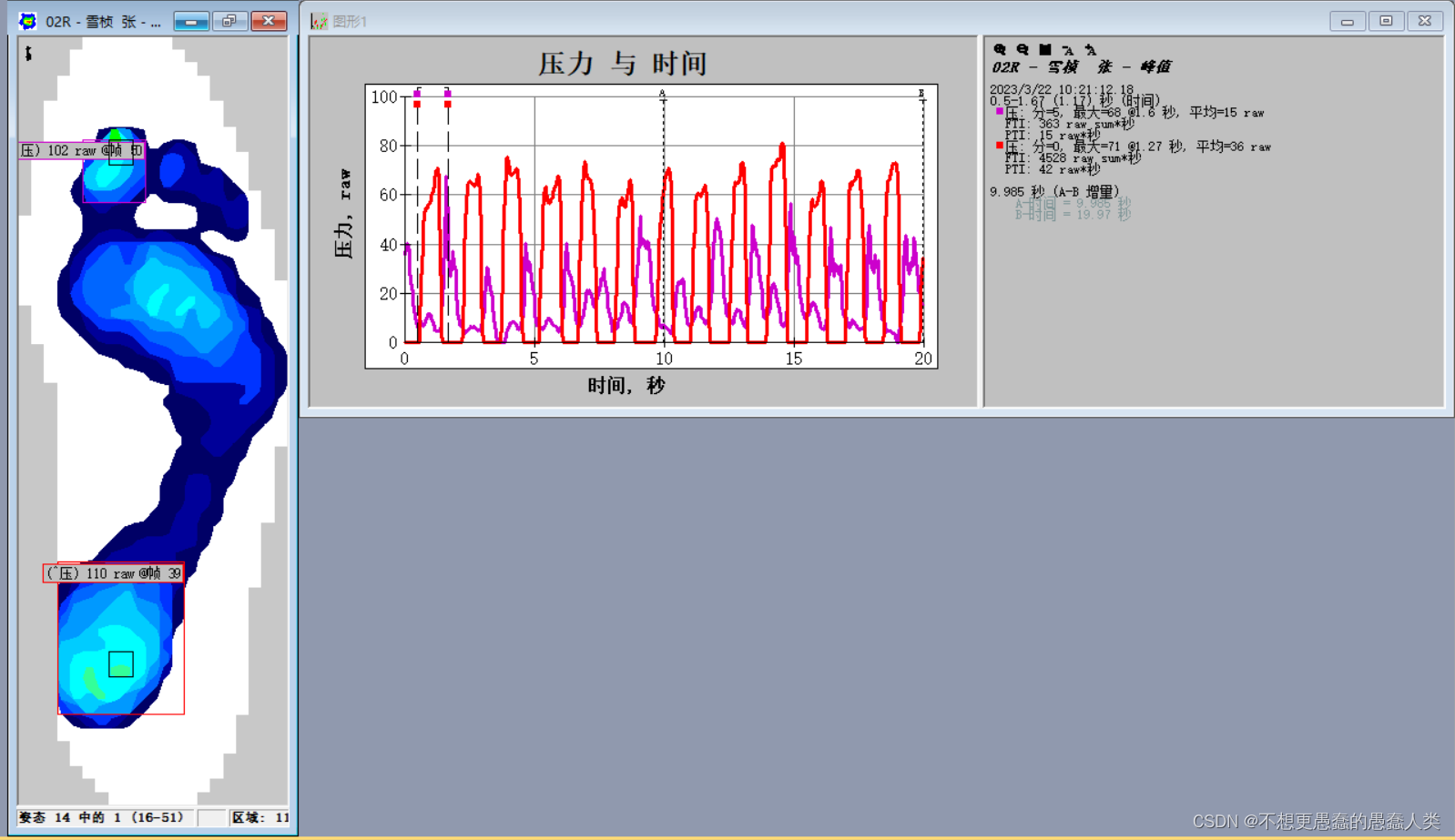 f-scan足底压力分析一：显示选项_足底压力数据集-CSDN博客